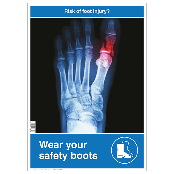 Risk Of Foot Injury Poster | Safety Posters | First Aid Posters ...